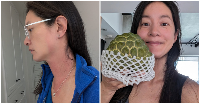 45歲Janet罹怪病！驚傳「高燒飆破40度」脖子全紅腫 查不出病因「改做一事」：症狀全消失 - 星奇趣味站